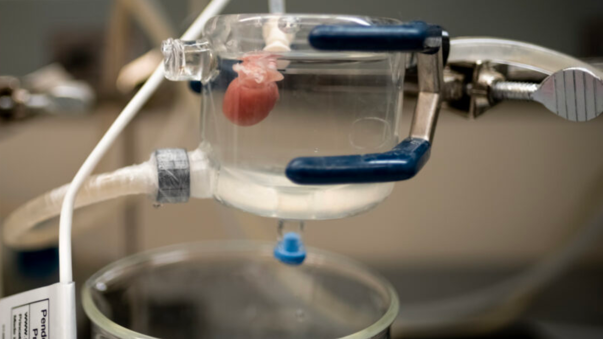 Cryopreservation: the future of organ transplant medicine